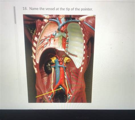 Solved Transcribed Image Text 17 Name The Labeled Vessel At The