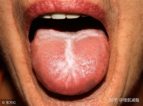 体内毒素堆满了，身体会给出5个信号！提醒你该排毒了 知乎