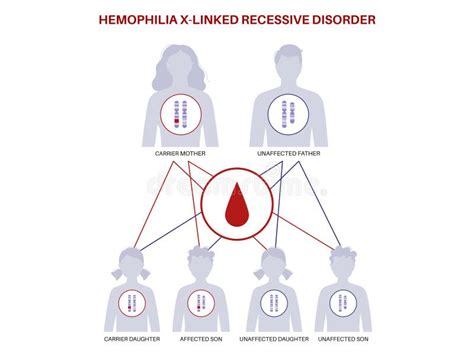 Hemophilia Inheritance Poster Stock Vector Illustration Of Clotting