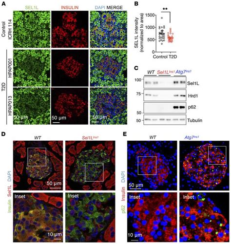 Jci Sel1l Hrd1 Er Associated Degradation Maintains β Cell Identity