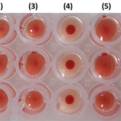 Hemagglutination And Inhibition Assays 1 Control Pbs 2 Ahp F2 Download Scientific