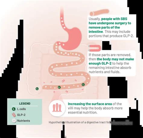Discover How Gattex® Teduglutide Works