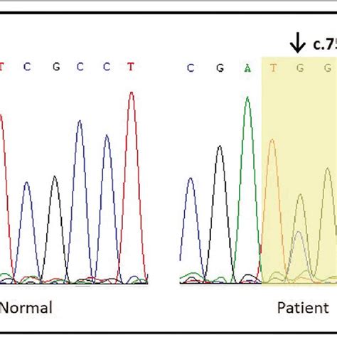 Partial Sequence Of Exon 7 In Fgfr2 Gene Arrow Indicates In The Download Scientific Diagram