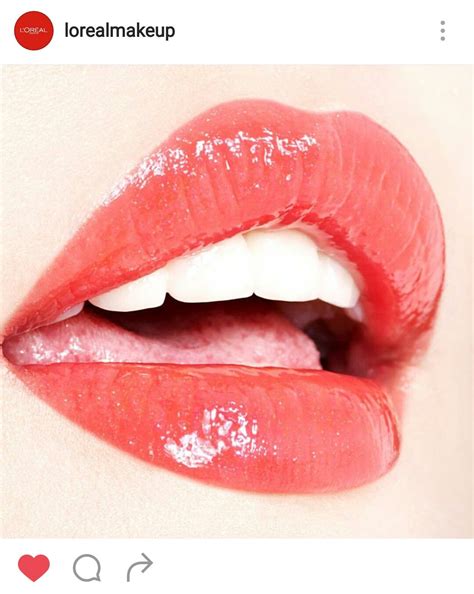 Botox Vs Fillers Uses Effects And Differences Artofit