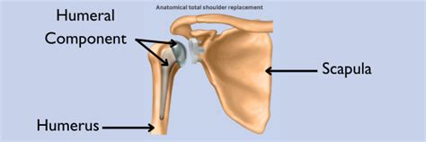 Shoulder Joint Weightlifters Shoulder Welwyn Garden City Clavicle