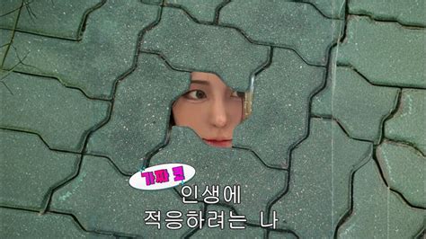 V Log 코수술 경과 한달차 5개월 재수술 존버를 곁들인 Youtube