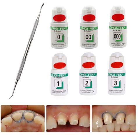 Dental Disposable Gingival Retraction Cord Plain Knitted Cotton Gingival Line Cm Cord Packer