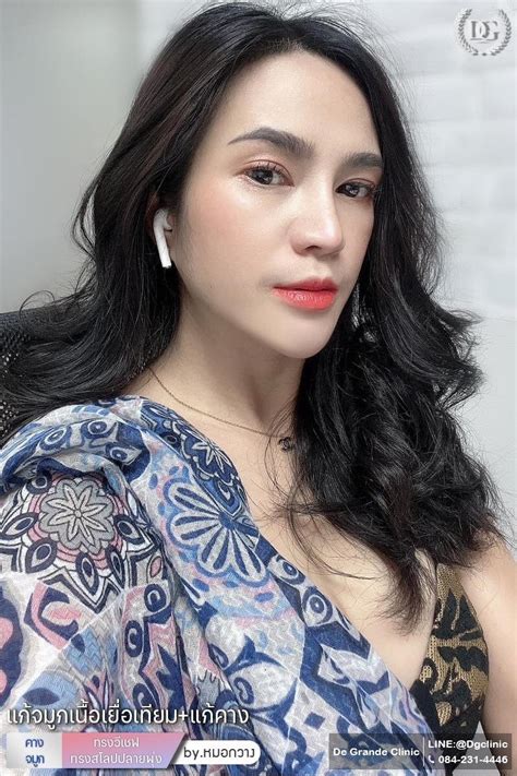 💞 สวยแซ่บ แบบแพ็คคู่ กับเคสเสริมคาง เสริมจมูก รองปลายเนื้อเยื่อเทียม By คุณหมอกวาง 👩‍⚕️ 🛑