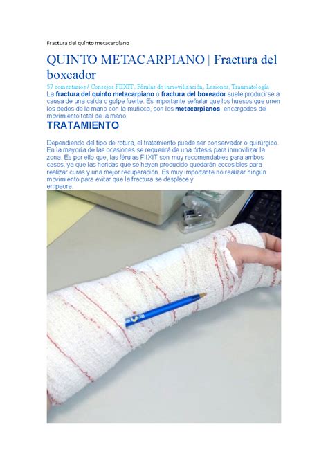 Fractura Del Quinto Metacarpiano Es Importante Señalar Que Los Huesos