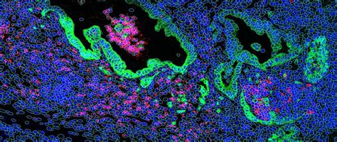 Tiledb Announces Development Preview Of Spatial Transcriptomics Features