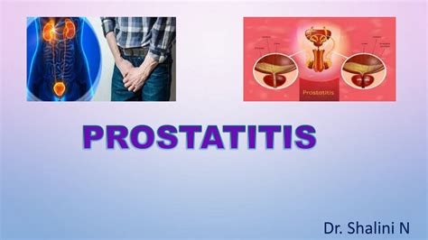 Prostatitis Ppt 1 Pptx