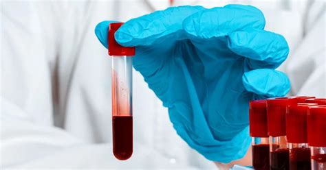 Melhorando Tratamentos E Metas Qual O Cronograma De Atividades Do Dia Mundial Da Hemofilia