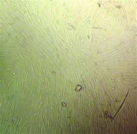 Morphology Of Amniotic Fluid Mesenchymal Stem Cells Download