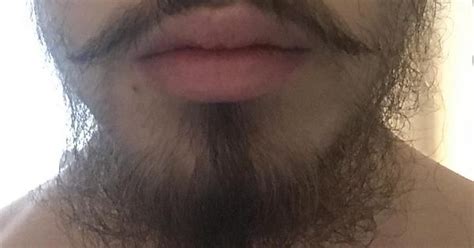 Beard Help Album On Imgur