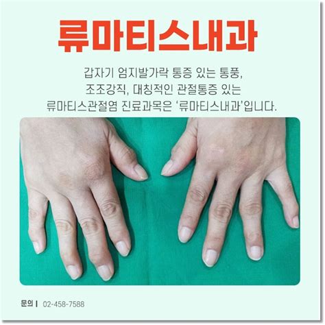 광진구 류마티스내과손가락 손목 통증 류마티스관절염 증상 네이버 블로그