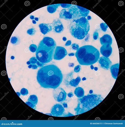 Mesothelial Cells