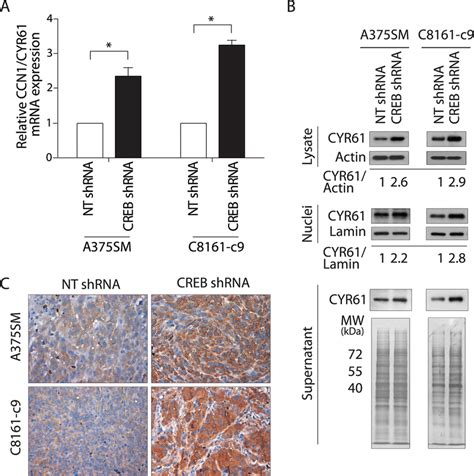 Validation Of Ccn1cyr61 Overexpression After Creb Silencing In