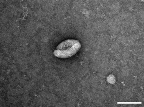 Characterization Of Human Pdlscs And Pdlsc Exos A D Isolation And Download Scientific