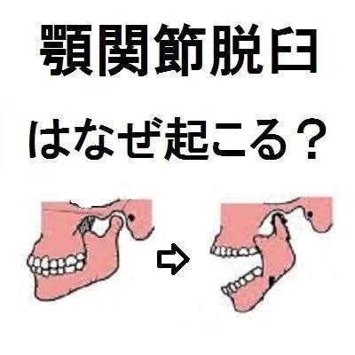 顎が外れたらどうする タニダ歯科医院西宮宝塚三田の歯医者
