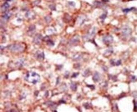 Ripk4 Polyclonal Antibody Invitrogen 400 μl Unconjugatedantibodies