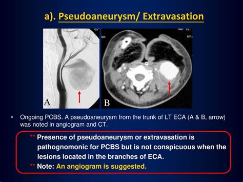 Dep Of Radiology Taipei Veterans General Hospital And Ppt Download