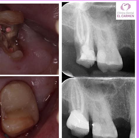 Clínica Dental El Carmen En La Clínica Dental El Carmen Hacemos Lo