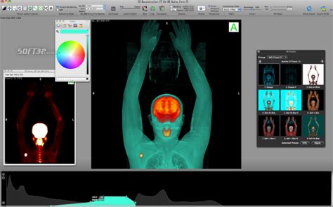 Osirix Free Dicom Viewer Utahlockq