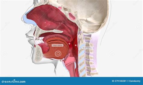 Anaphylaxis Is A Severe Systemic Allergic Reaction Characterize Stock