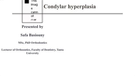 Condylar Hyperplasia And Othodonticspptx