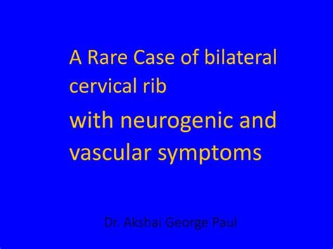 Cervical Rib A Rare Case Of B L Cervical Rib Pptx