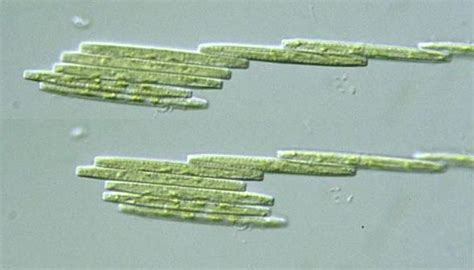 Protist Images Bacillaria Paradoxa