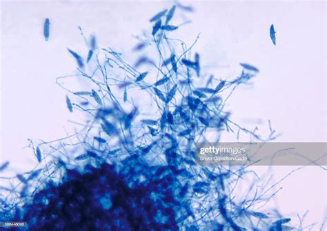 This Is A Photomicrograph Of The Fungus Microsporum Gypseum Using The