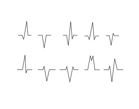Ecg Notching Quiz