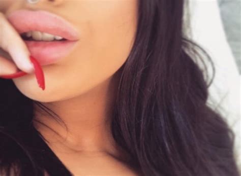 Lip Fillers Guide Types Of Lip Injections Costs And Side Effects