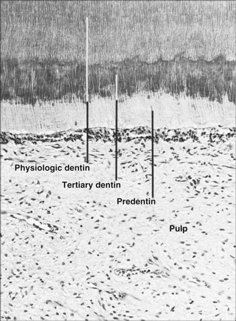 8 Dentin Pulp Complex Pocket Dentistry