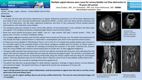 Pdf Ct Shows Pelvic Mass Multiple Vaginal Abscess Were Cause For