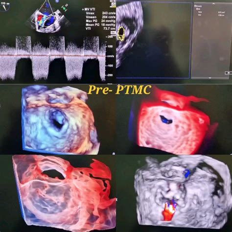 Dil Kumar On Linkedin Ptmc Truevue Glassvue Philips