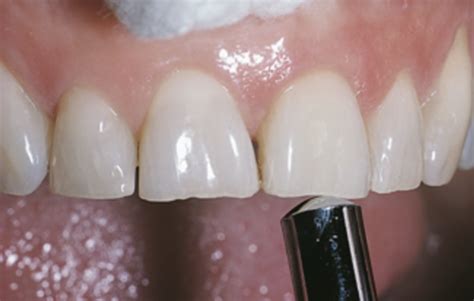 Theory Week 13 Flashcards Quizlet