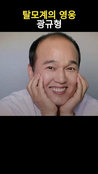 탈모계의 전설로 불리는 남자 Youtube