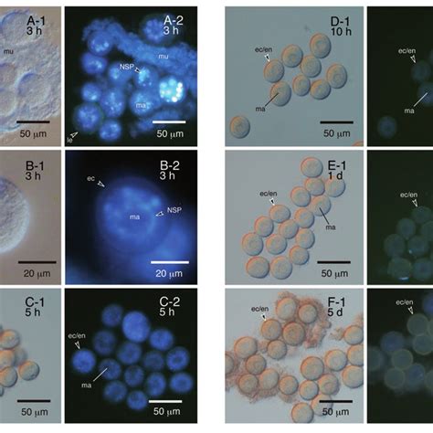 Nomarski Images A 1F 1 And Their Fluorescence Photomicrographs