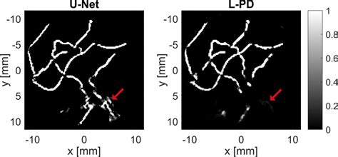 Segmentations Of Experimental Phantom Using A Limited View Placement Of Download Scientific