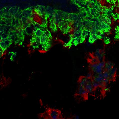 Seemingly Inconsistent Inverted Lut Behavior Image Analysis Image Sc Forum