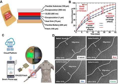 Wearable Electronics For Skin Wound Monitoring And Healing PMC