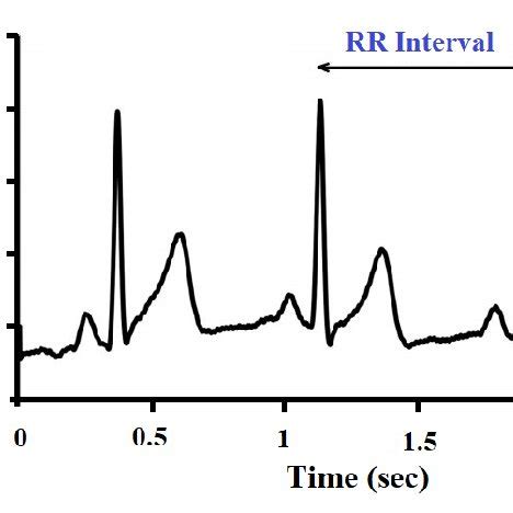 Cardiac Signal And Display Of R R Interval Download Scientific Diagram