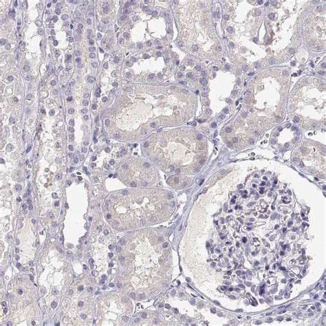 Anti Cdhr1 Human Protein Atlas Antibody