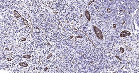 Human Cd31 Ready To Use Ihc Kit Bioss