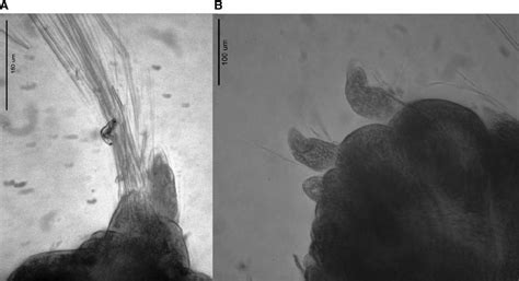 Linopherus Cf Canariensis Langerhans 1881 A Forked Denticulated