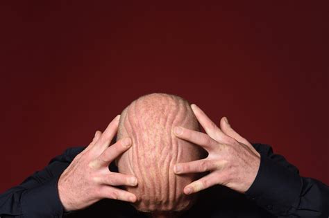 Powerful These Photos Of Frowning Bald Men Are A Sobering Reminder