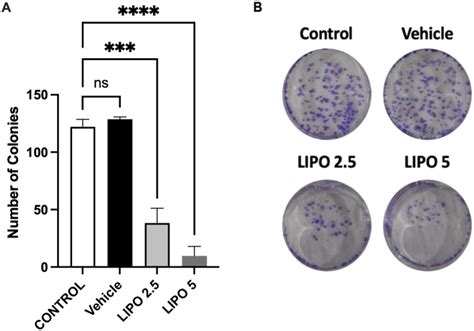 Liposomal Encapsulated Curcumin Attenuates Lung Cancer Proliferation