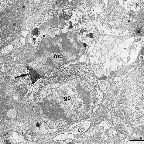 Electron Micrograph Of A Transcellularly Labelled Microglial Cell Mc Download Scientific